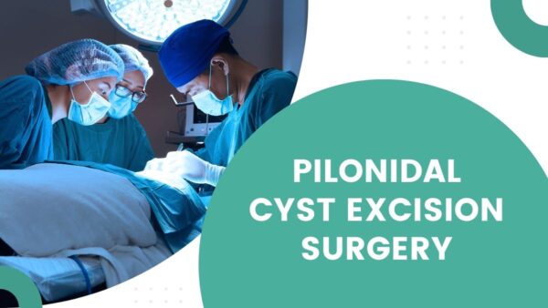 How to Prepare for Pilonidal Cyst Removal